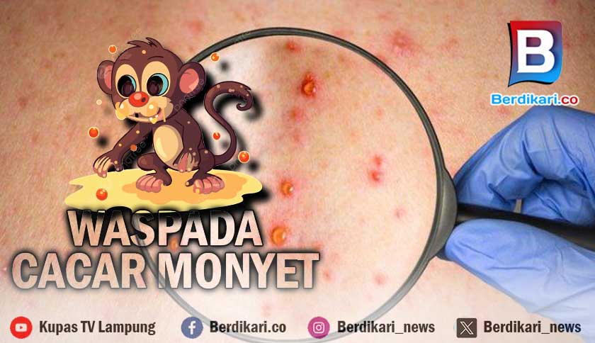 Berdikari - Antisipasi Penularan Cacar Monyet, Pemprov Lampung Perketat Pemeriksaan di Bandara ...
